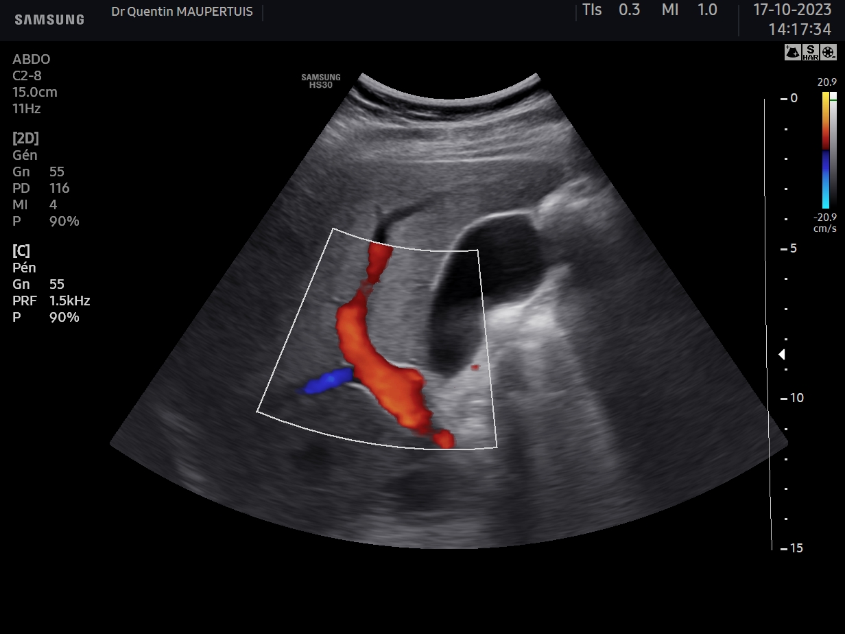 L’échographie hépatique partie 1 : Méthode. – Échoclic