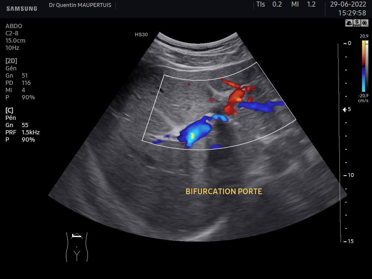 L’échographie hépatique partie 1 : Méthode. – Échoclic